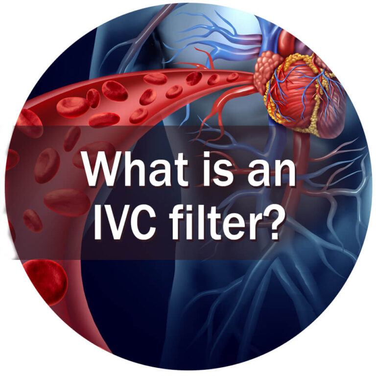 What are the different types of IVC filters? - The Dysart Law Firm, P.C.